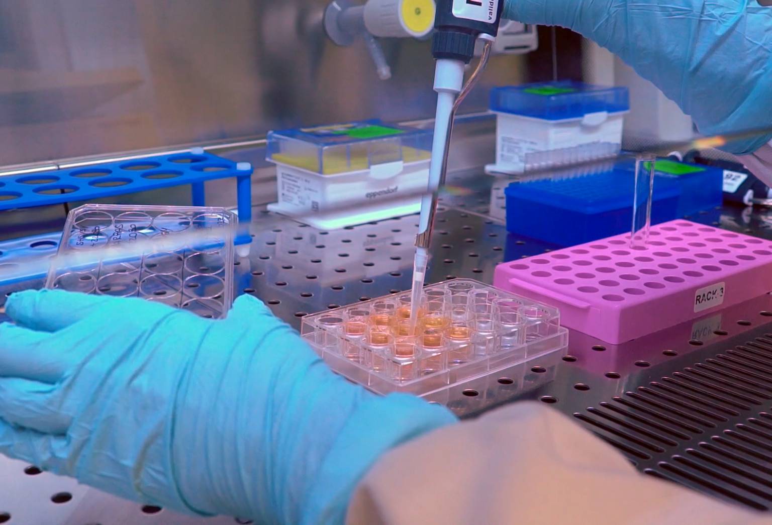 Carcinoma uroteliale, via libera a monoterapia orale dal Chmp dell'Ema