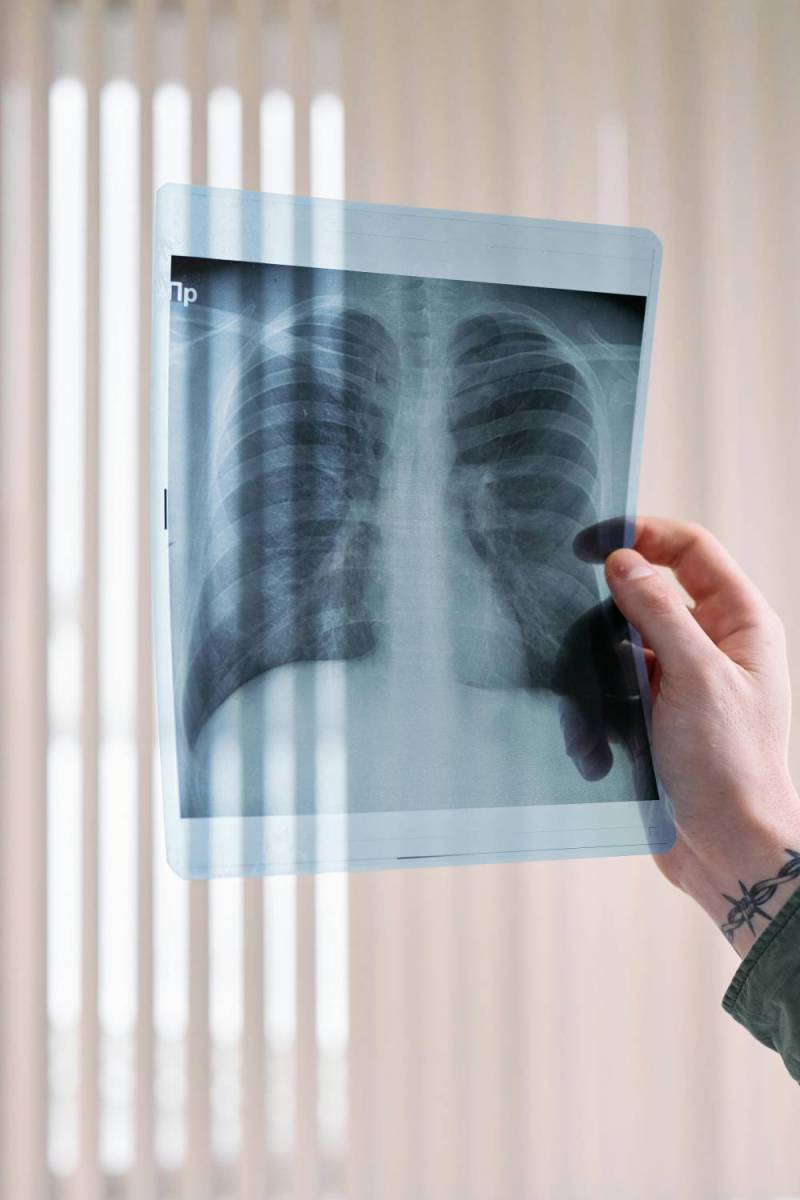 Cancro ai polmoni, nei non fumatori è (anche) l'inquinamento a ...